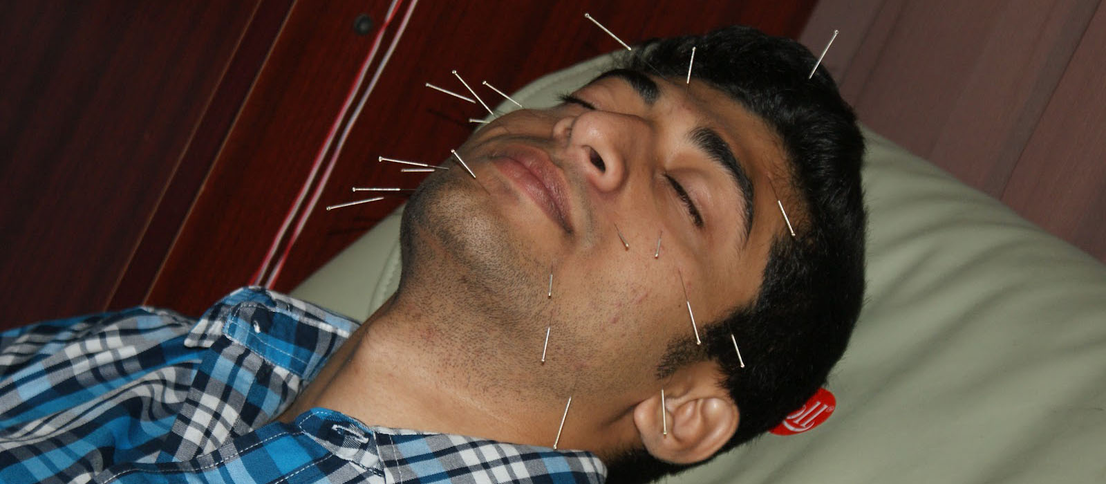 Acupuncture-treatment | CT Mirror