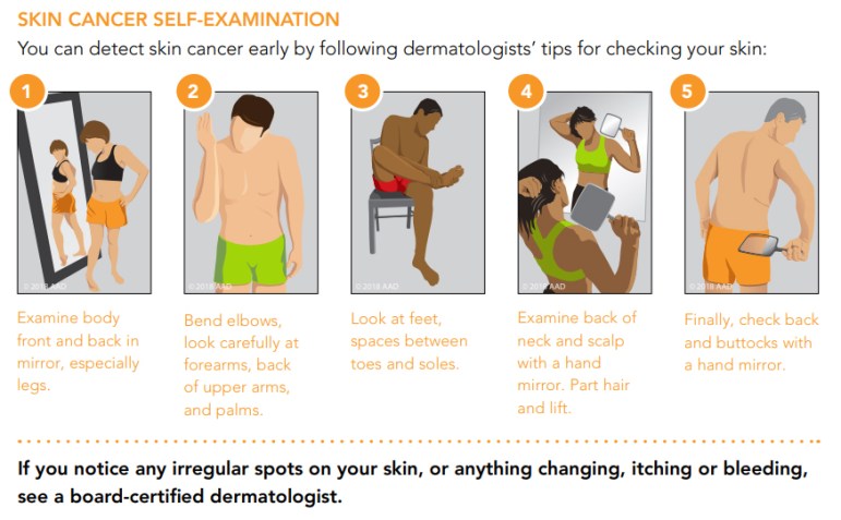 skin cancer check | CT Mirror