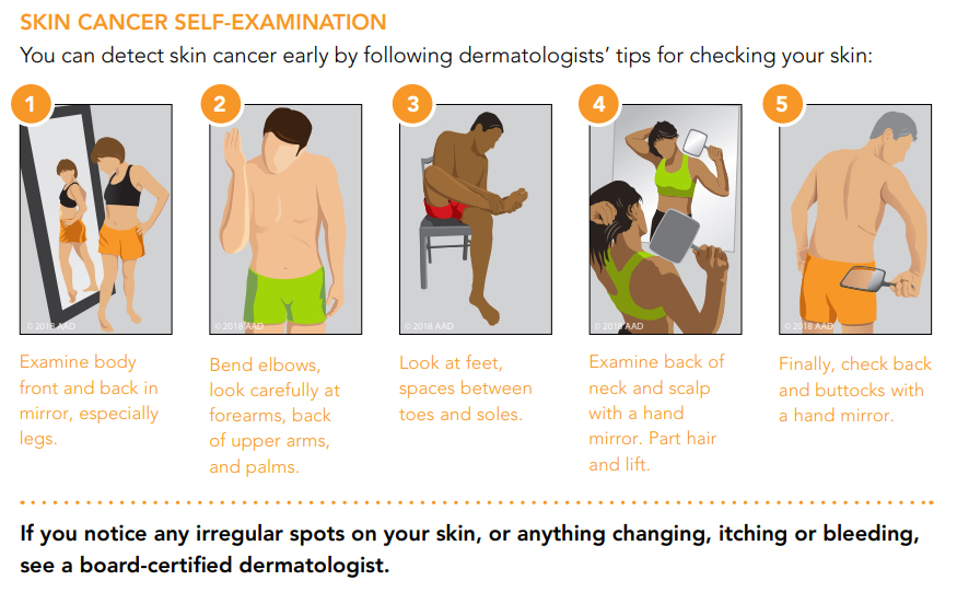 Opinion: I'm a CT dermatologist. You should check for skin cancer